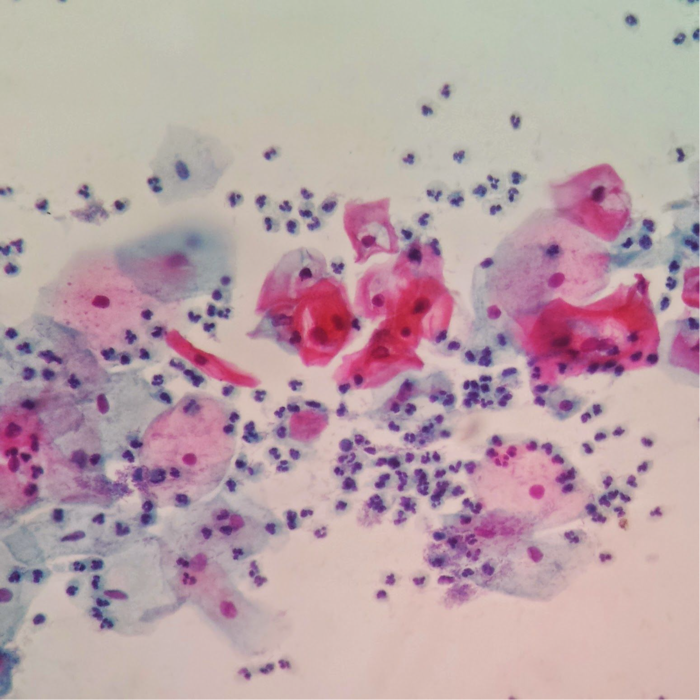 Laboratorio Angeleri - Análisis Clínicos - Papanicolaou